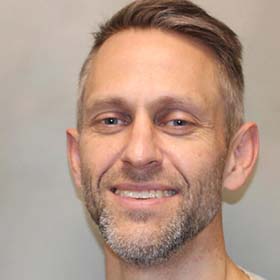 Y-90 radioembolization for liver cancer - Mayo Clinic Health System